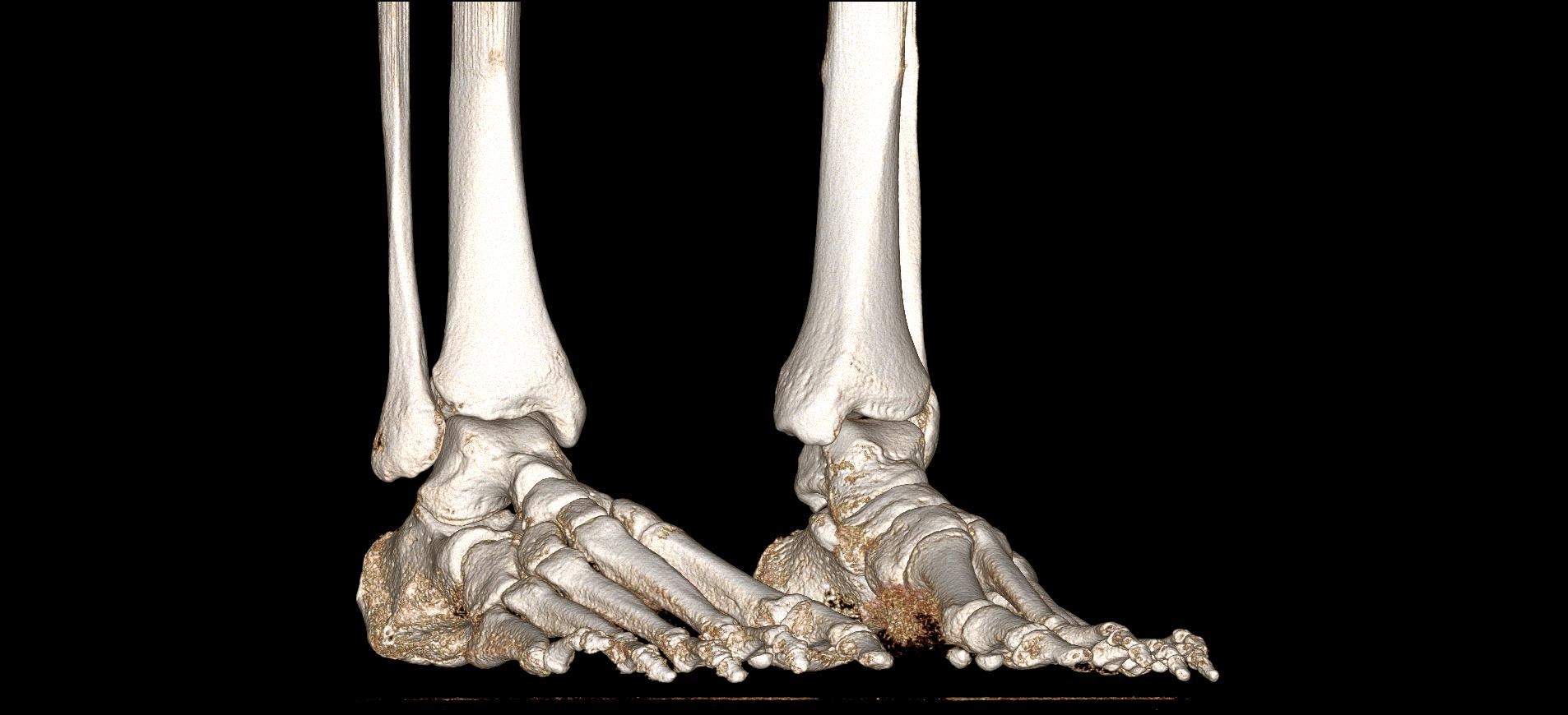 FARIL – Foot & Ankle Research and Innovation Laboratory