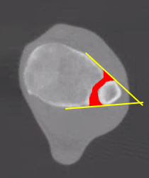 FARIL – Foot & Ankle Research and Innovation Laboratory